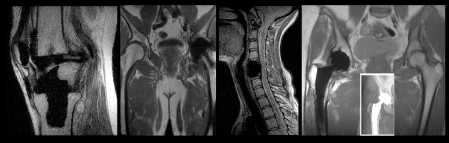 Strong Large Neodymium Magnets for MRI Use - MagnetsTek